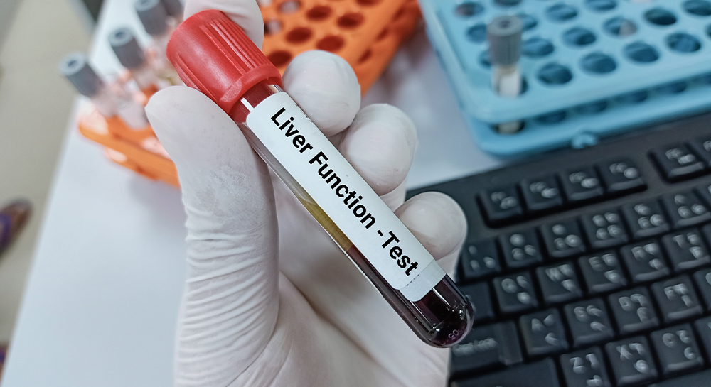 Decoding Liver Function Tests (LFTs): Results Explained